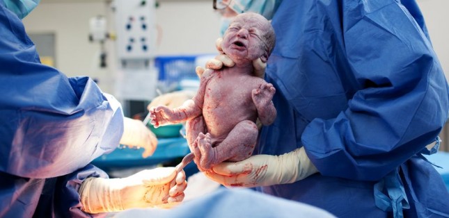 Caesarean in Detail - Kiwi Families
